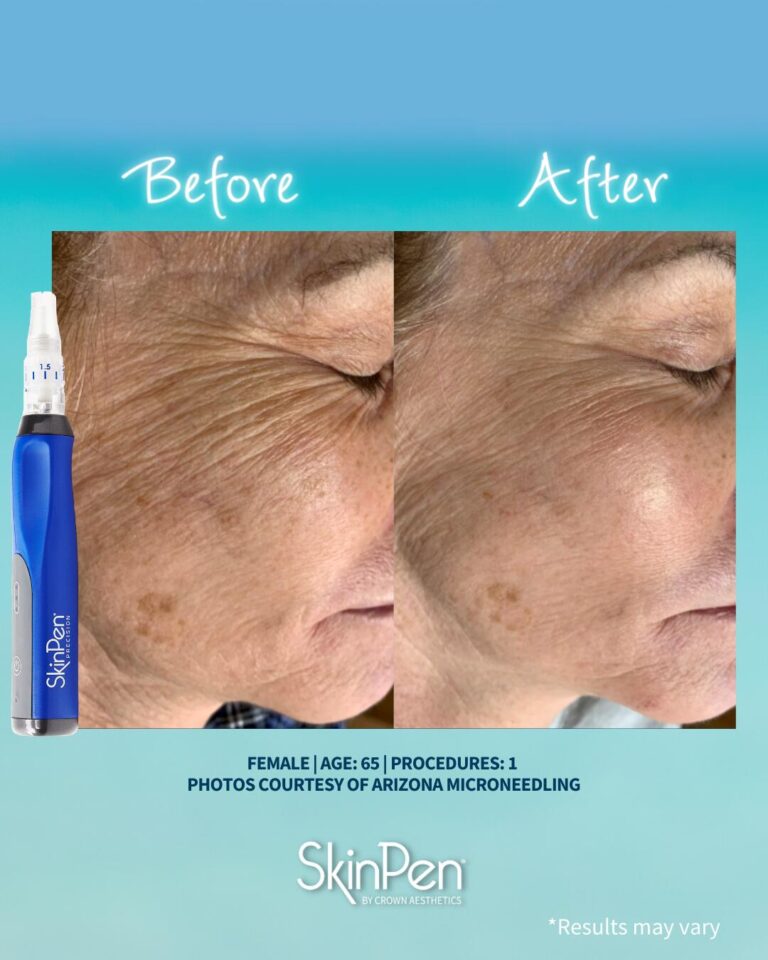 SKINPEN - Machynys Peninsula Golf Club and Premier Spa