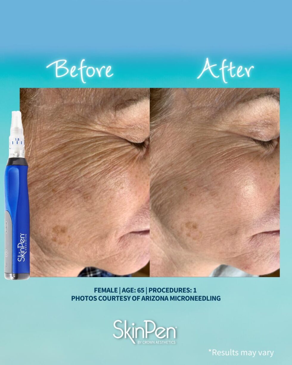 SKINPEN - Machynys Peninsula Golf Club and Premier Spa